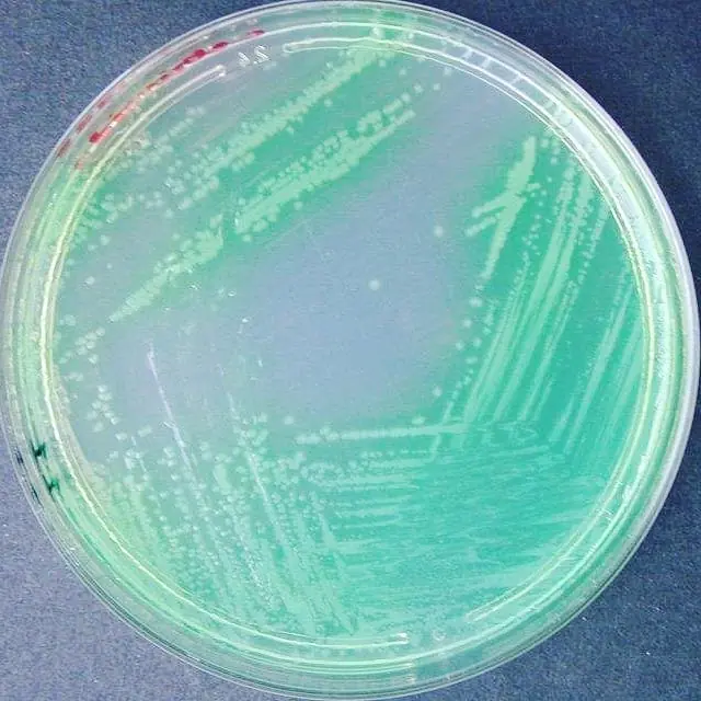 Cetrimide Agar | Principle | Preparation | Results