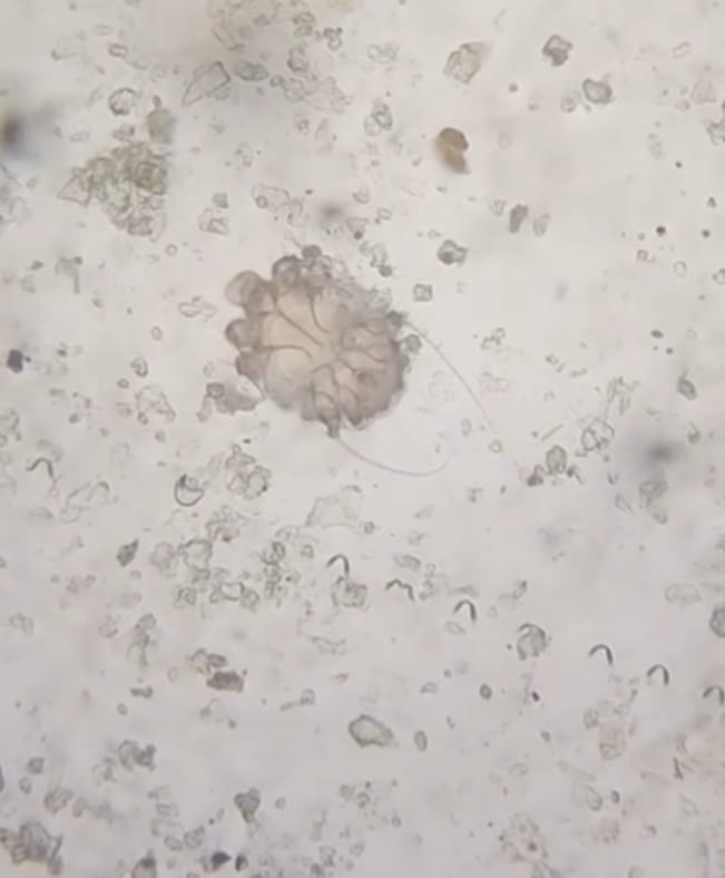 Sarcoptes scabiei : Classification, Manifestations cliniques et ...