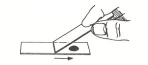 Coloration Negative (Encre de Chine/Nigrosine)