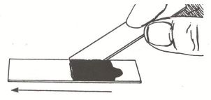 Coloration Negative (Encre de Chine/Nigrosine)