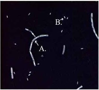 Coloration Negative (Encre de Chine/Nigrosine)