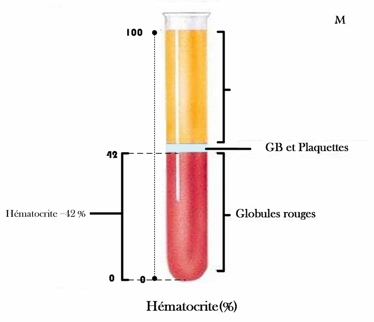Hématocrite: Taux, Bas, Elevé, Causes et Signification Clinique
