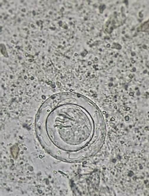 Hymenolepis nana (Ténia nain) : Classification, Manifestations ...